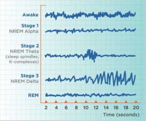 Sleep Science - Hypnosis for CEOs and Leaders Dealing with Insomnia